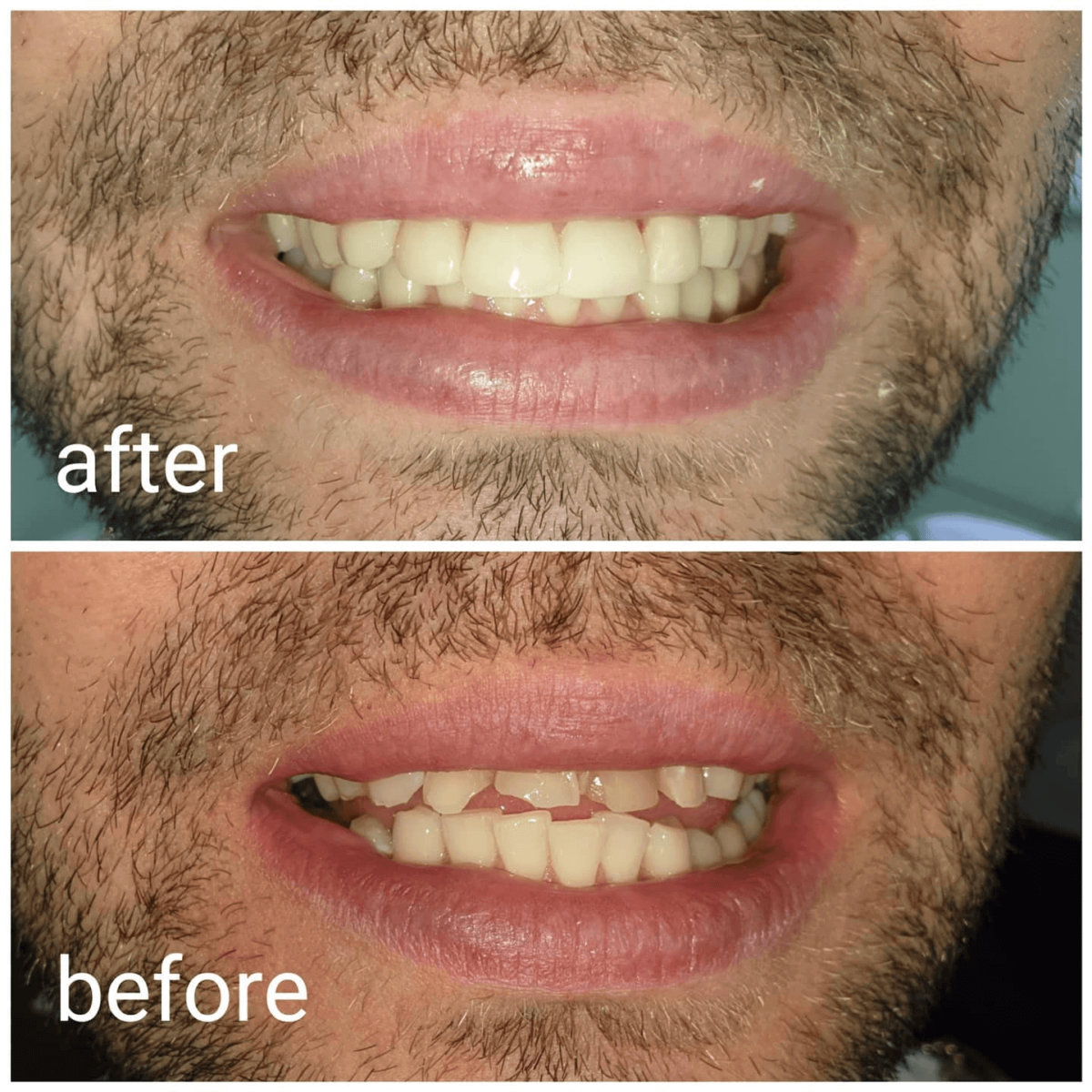 Case Studies - Dentist Grinstead